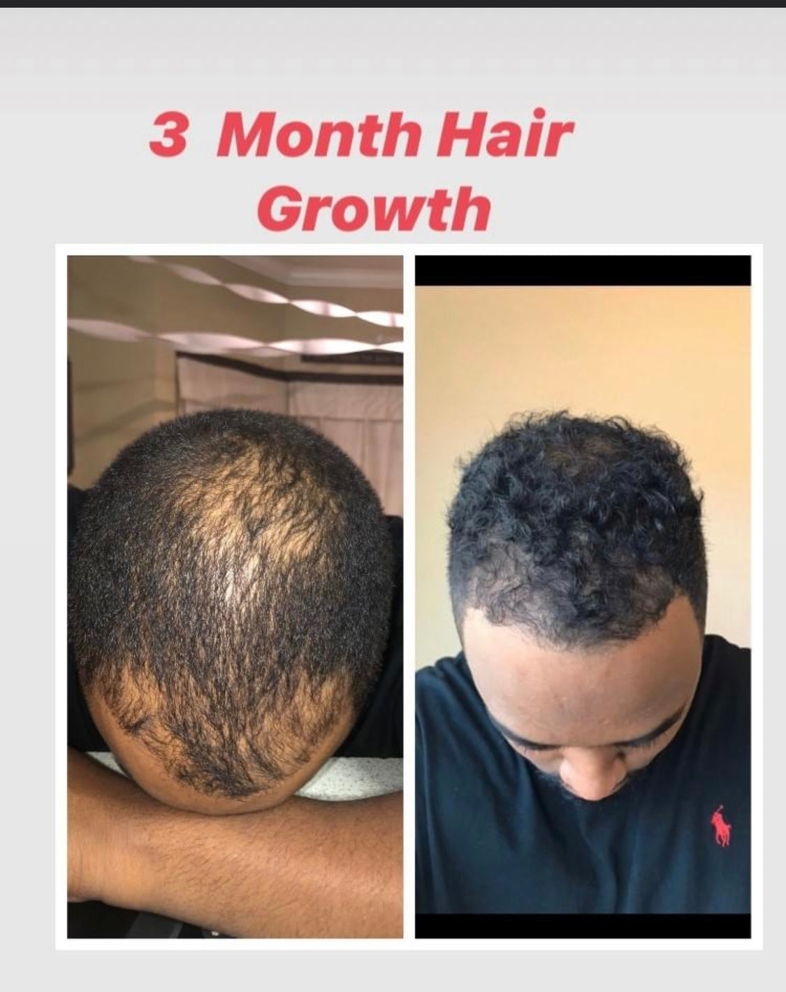 Hair and Beard Growth Oil – mimiscurlz